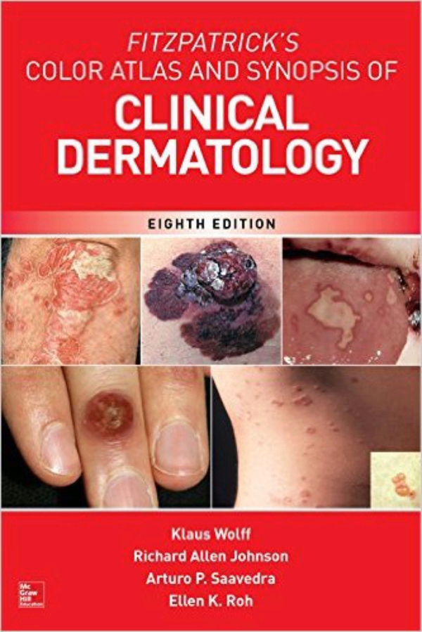 Fitzpatrick. Color Atlas and Synopsis of Clinical Dermatology