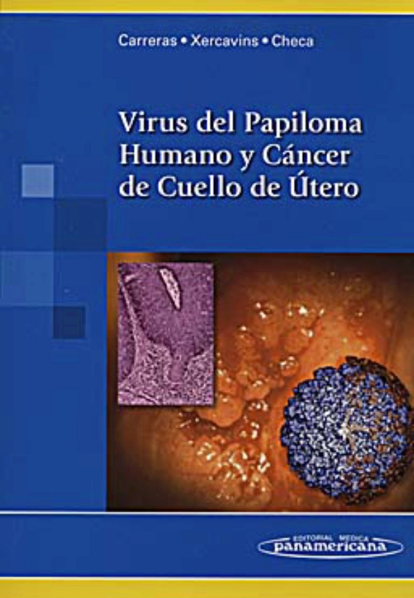 Virus del Papiloma Humano y Cancer de Cuello de Utero
