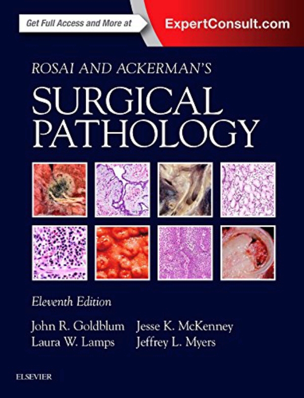 Rosai and Ackerman. Surgical Pathology